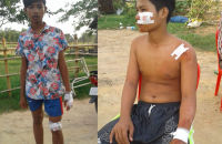 បើកម៉ូតូលឿន បុកក្មេងស្រីរត់ឆ្លងថ្នល់ របួសធ្ងន់ស្រាល៤នាក់ - TNAOT