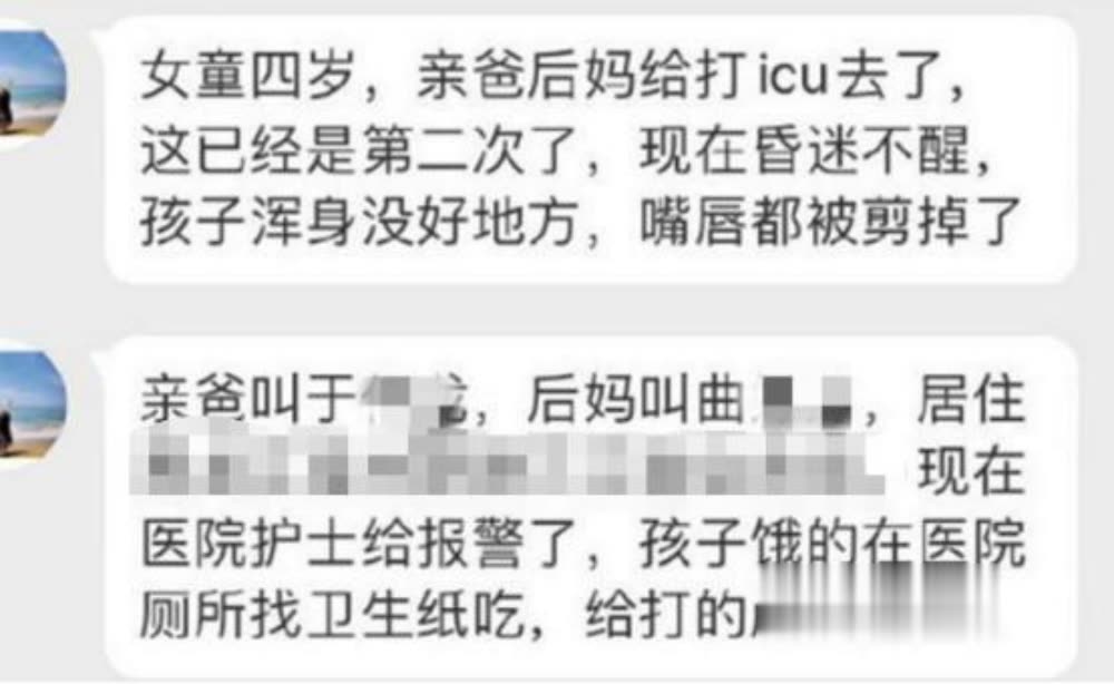 继母把4岁女孩打成颅内出血，嘴唇也被剪掉，父亲表示我没参与 Tnaot